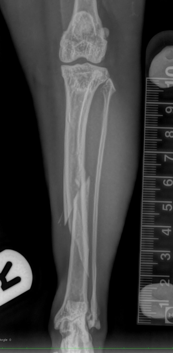 Tilly – tibial fracture to right hind leg - Meopham